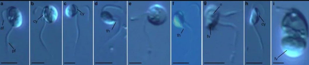 Scoperto un nuovo supergruppo di microorganismi eucarioti predatori: i ...